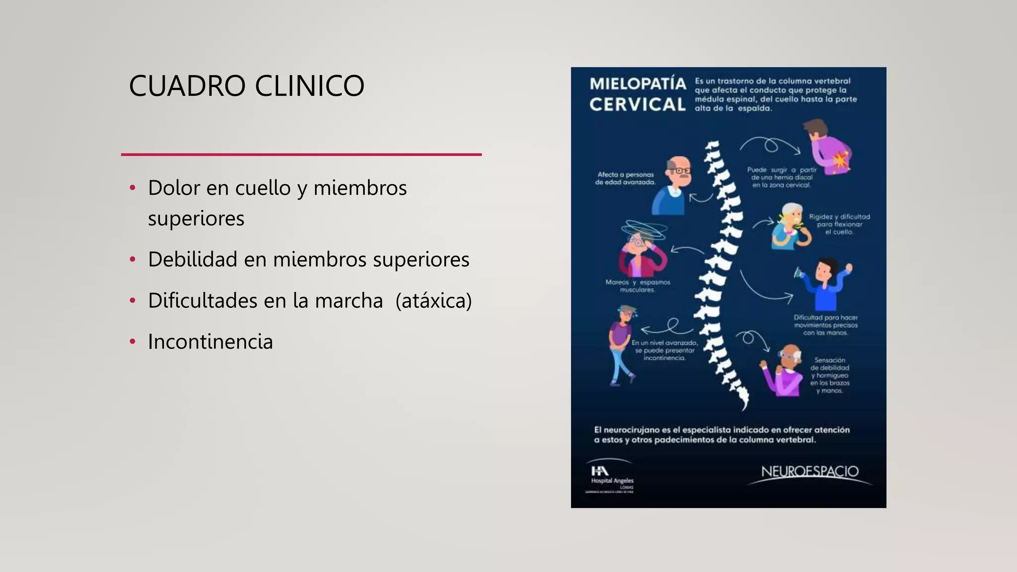 Mielopatia cervical.pptx