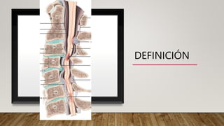 Mielopatia cervical.pptx