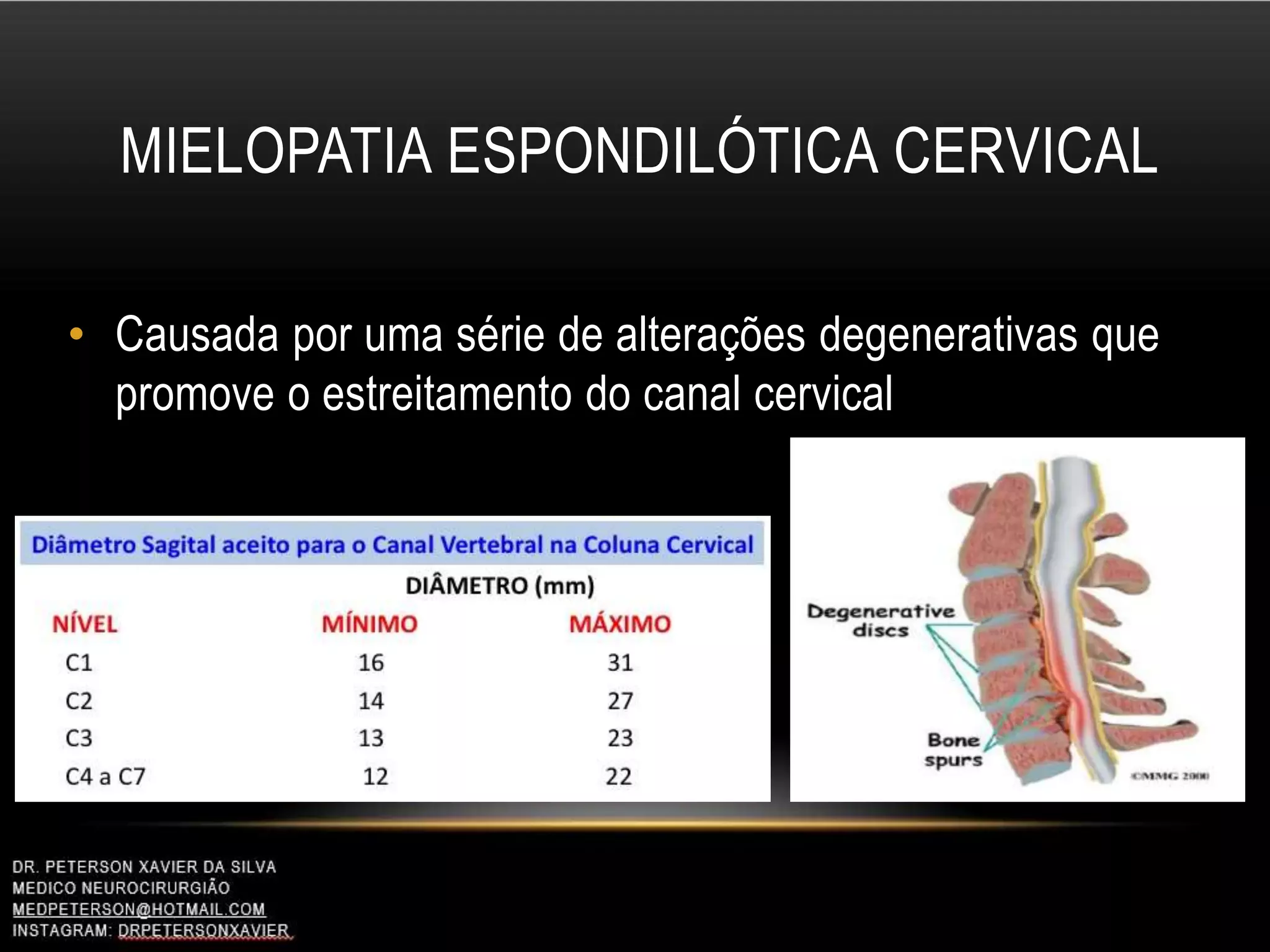 MIELOPATIA ESPONDILÓTICA CERVICAL | PPT