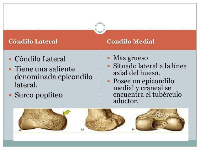 Miembro inferior Huesos