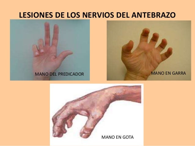 ANATOMIA DE LOS Miembro superior