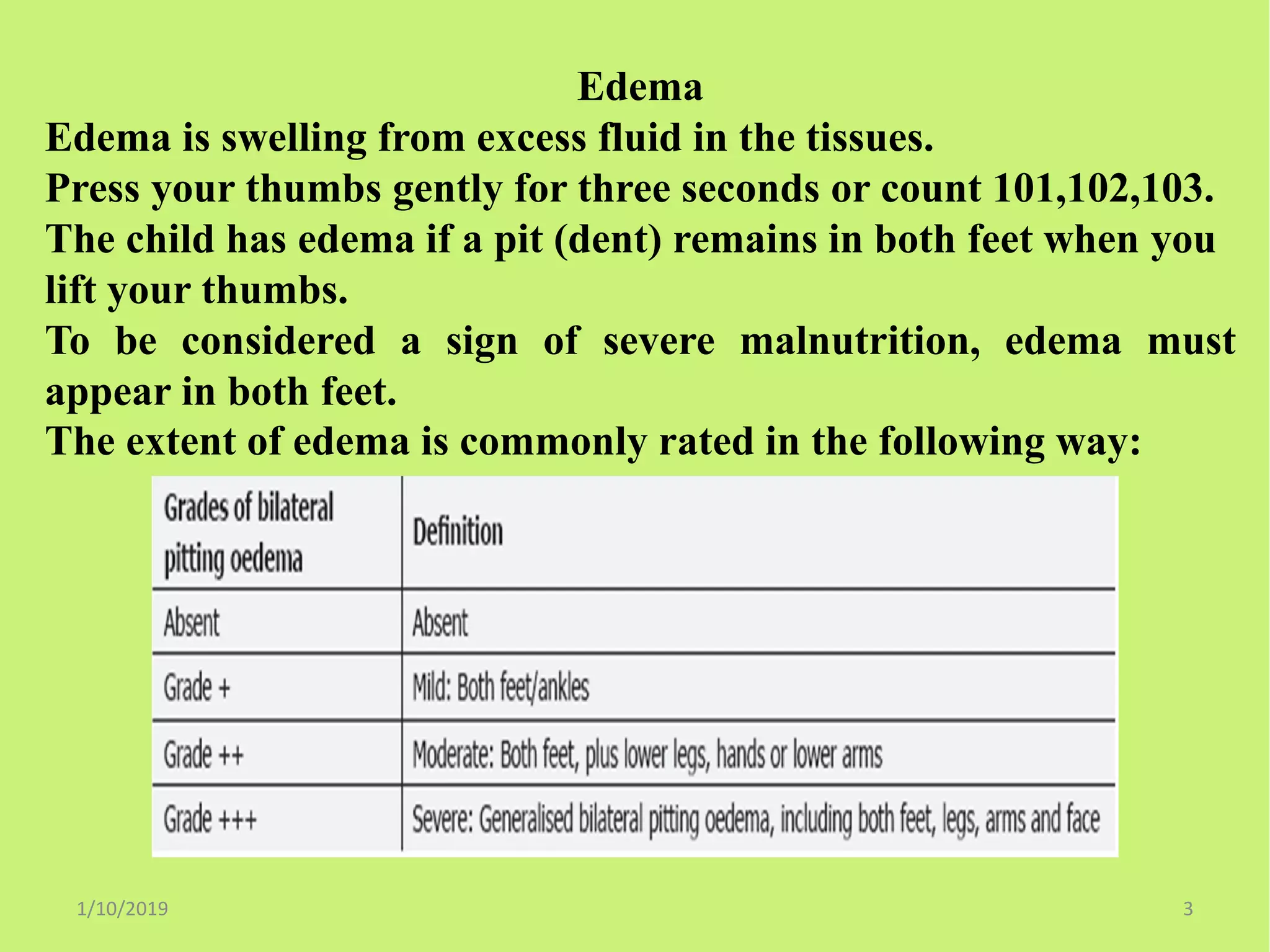 Management Guidelines of Severe Acute Malnutrition SAM in Pediatrics | PDF