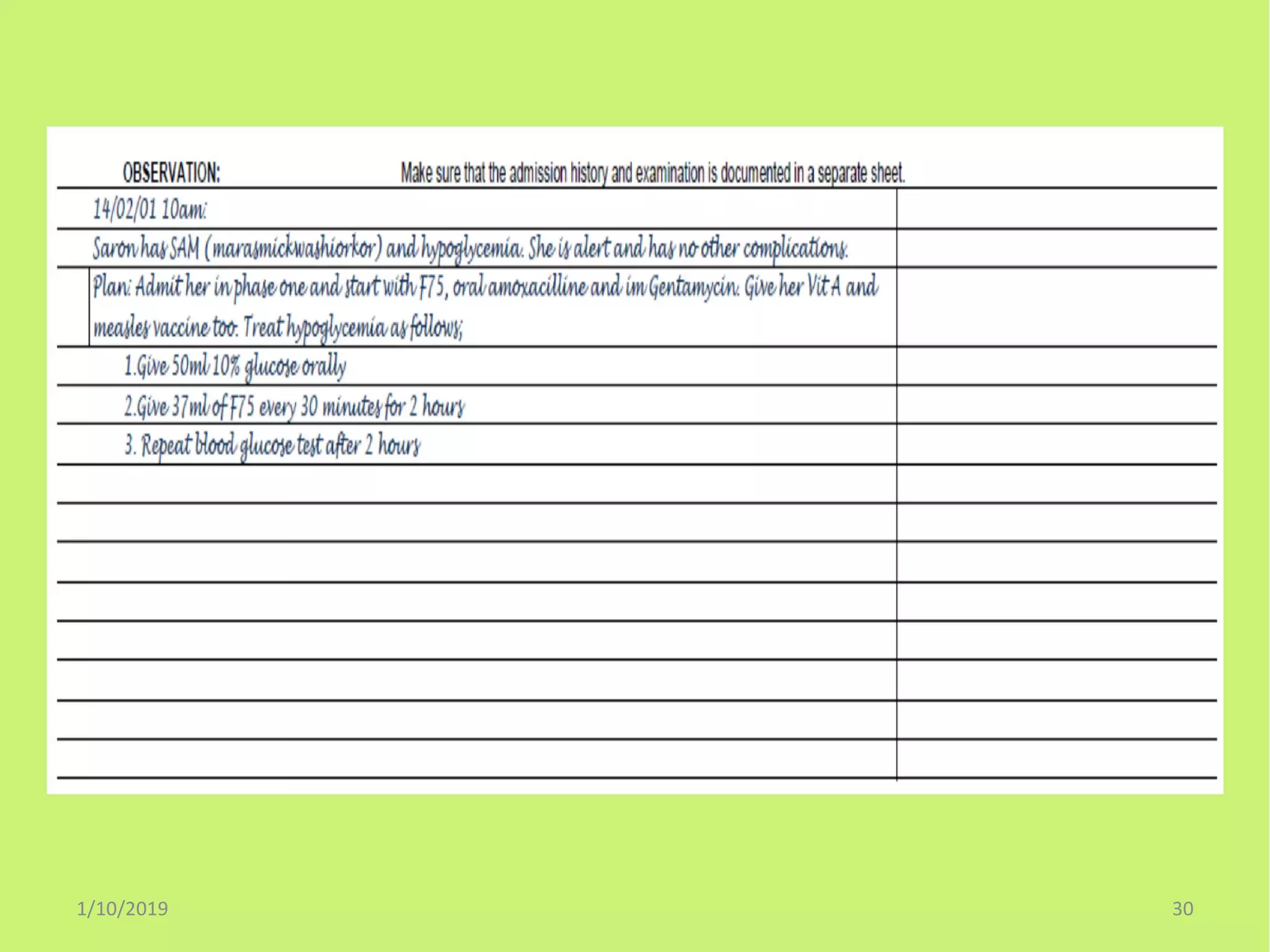 Management Guidelines of Severe Acute Malnutrition SAM in Pediatrics | PDF