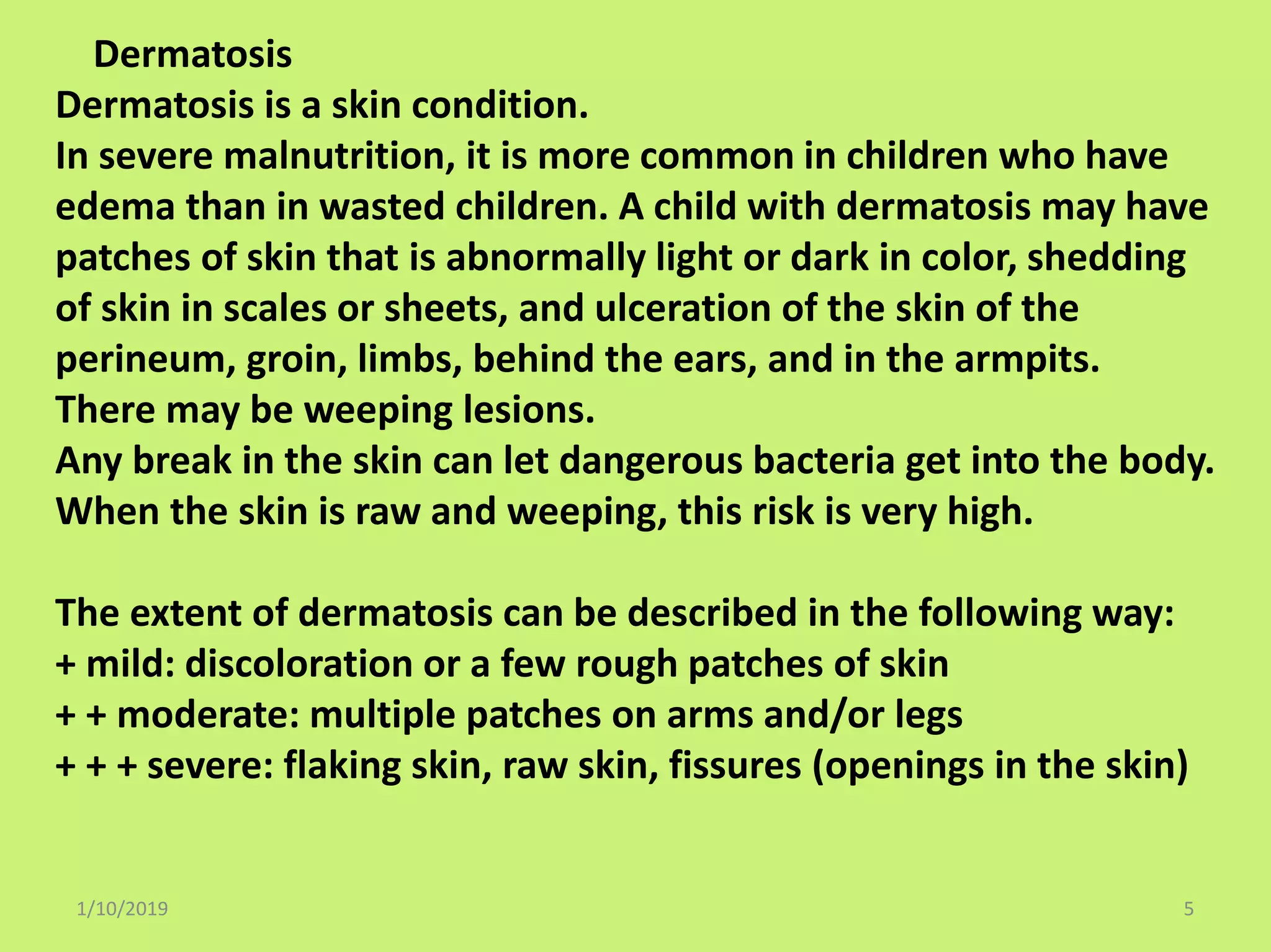 Management Guidelines of Severe Acute Malnutrition SAM in Pediatrics | PDF