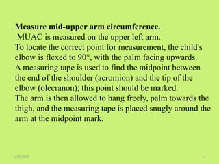 Management Guidelines of Severe Acute Malnutrition SAM in Pediatrics | PDF