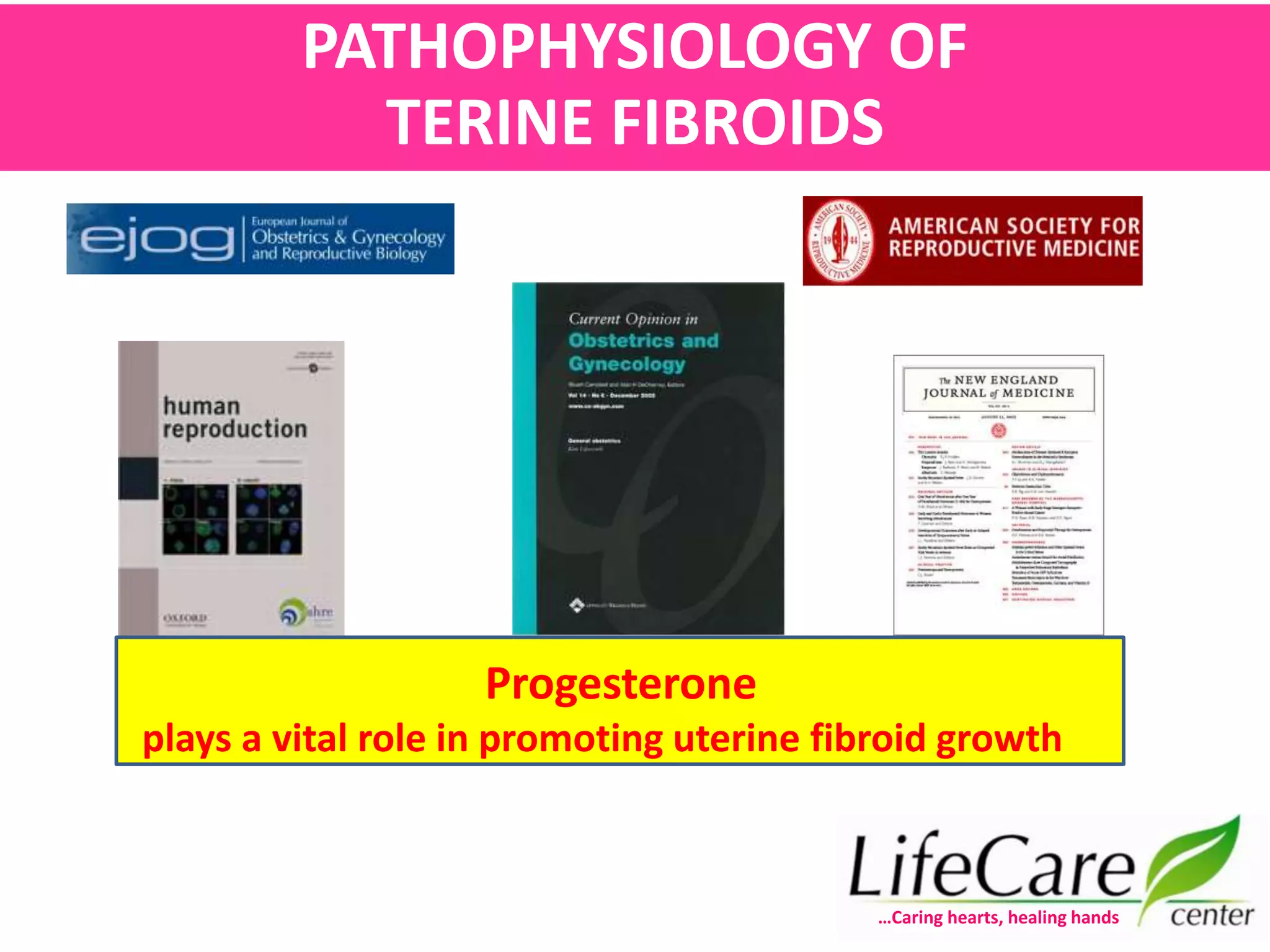 Low Dose Mifeprostone in the Management of Fibroid Dr Sharda Jain | PPTX