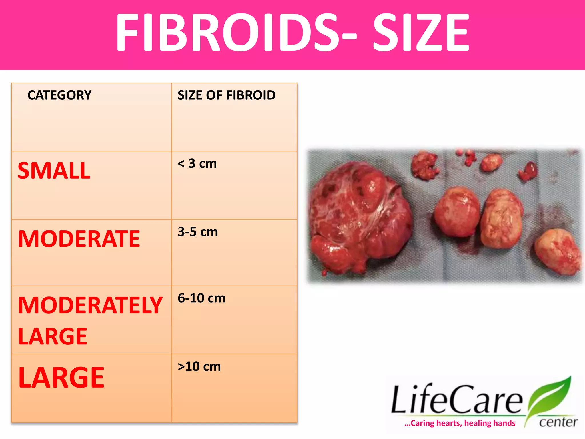 Low Dose Mifeprostone in the Management of Fibroid Dr Sharda Jain | PPTX