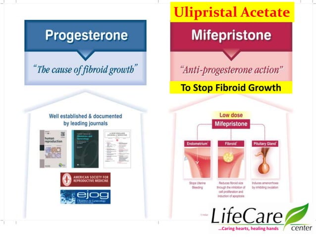 Low Dose Mifeprostone in the Management of Fibroid Dr Sharda Jain | PPTX