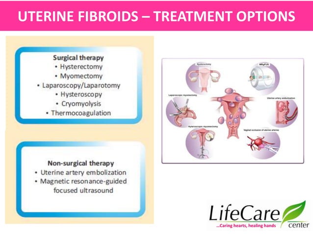 Low Dose Mifeprostone in the Management of Fibroid Dr Sharda Jain | PPTX