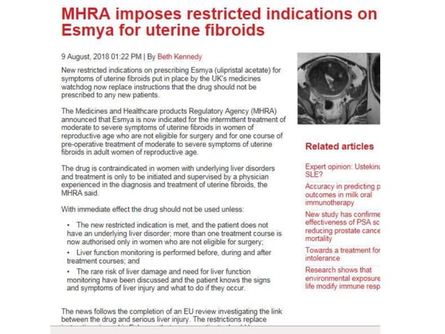 Low Dose Mifeprostone in the Management of Fibroid Dr Sharda Jain | PPTX