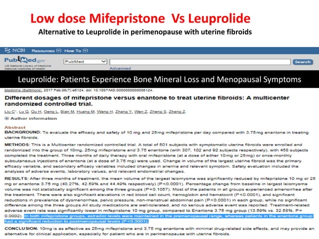 Low Dose Mifeprostone in the Management of Fibroid Dr Sharda Jain | PPTX