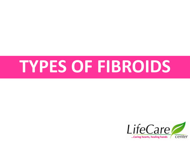 Low Dose Mifeprostone in the Management of Fibroid Dr Sharda Jain | PPTX