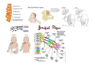migrain materi neurologi nyeri kepala, vertigo, tth.docx