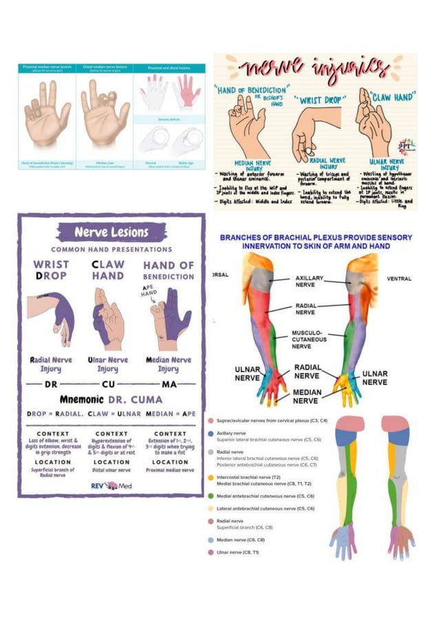 migrain materi neurologi nyeri kepala, vertigo, tth.docx