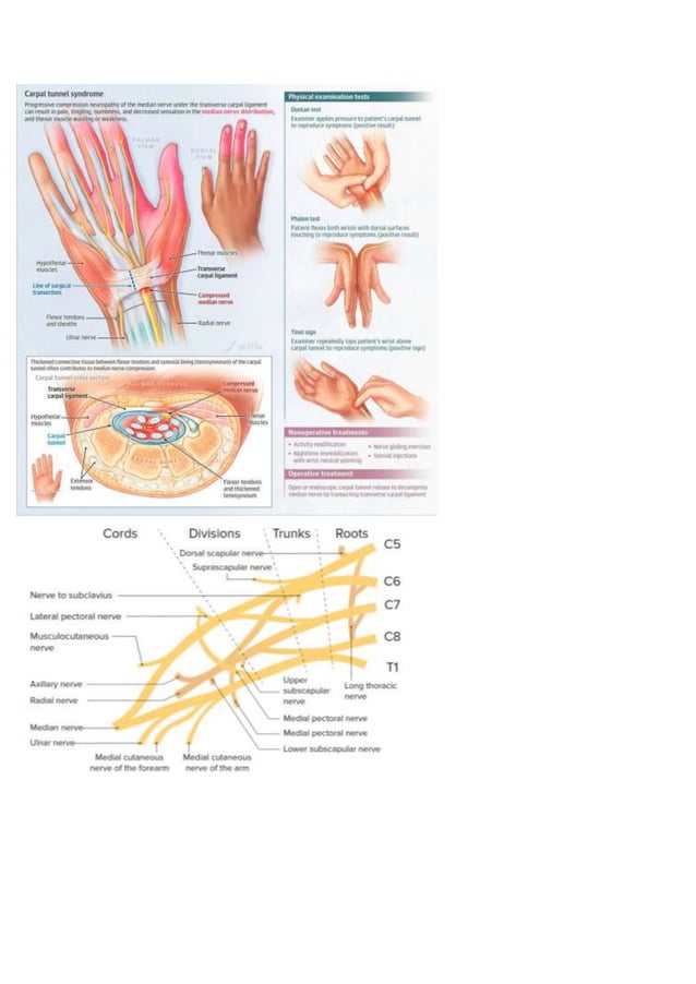 migrain materi neurologi nyeri kepala, vertigo, tth.docx