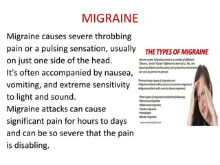 Migraine | PPT