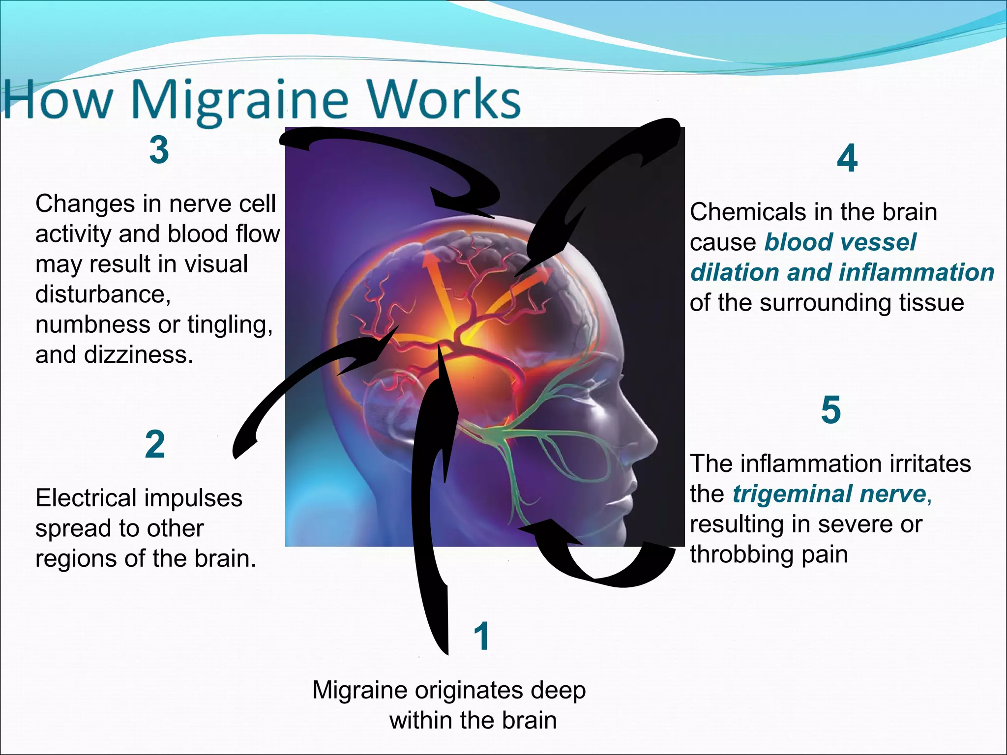 Migraine its presentation and management | PPT