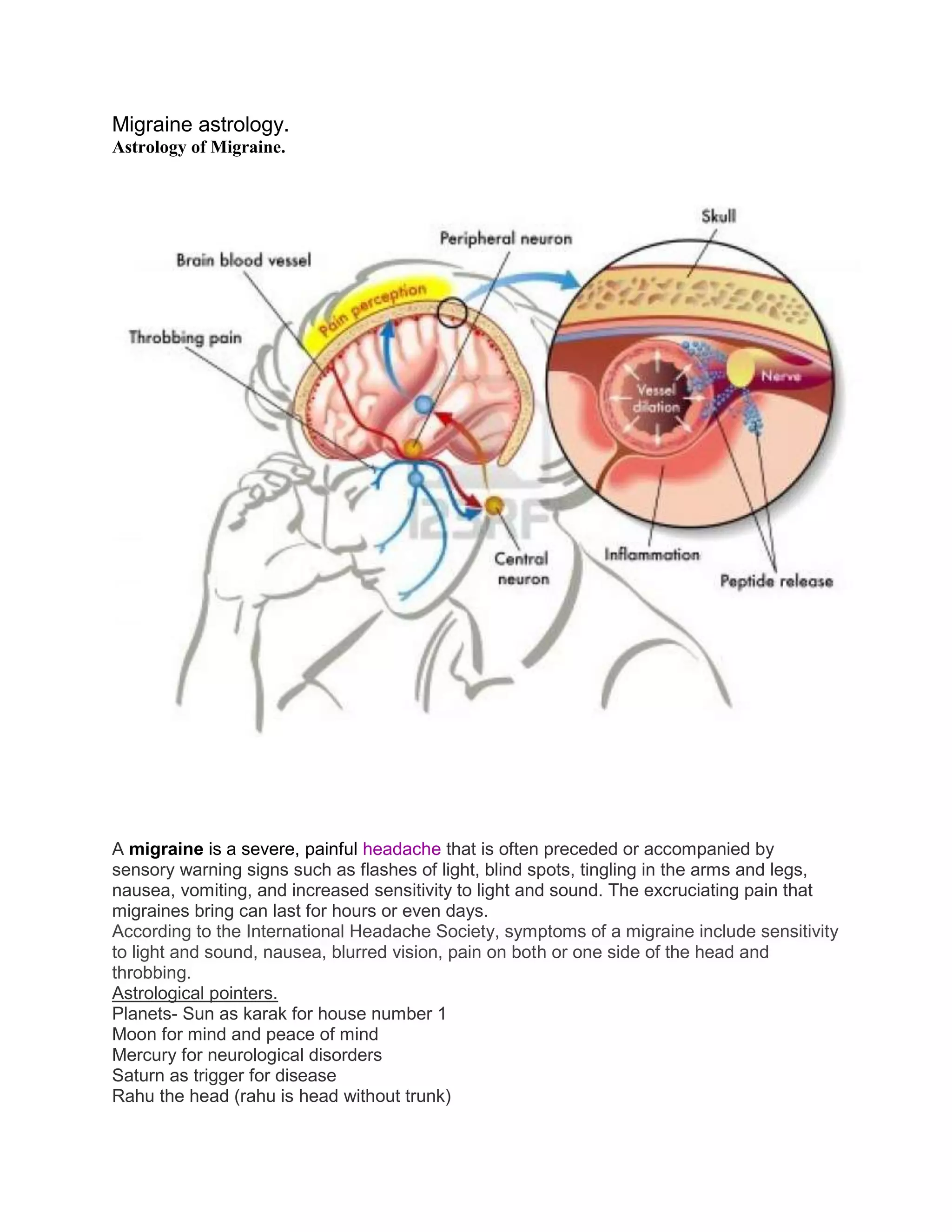 Migraine astrology | DOCX