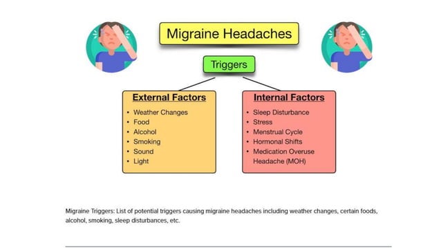 MIGRAINE OVERVIEW FOR NEUROLOGIST AND GENERAL PRACTIONER | PPTX | Brain ...