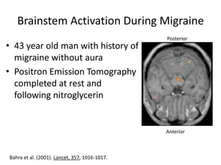 Pathophysiology: Migraine & Headache | PPTX