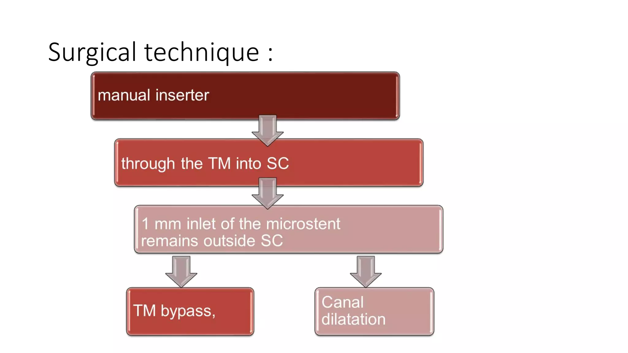 Minimally invasive Glaucoma surgery MIGS | PPTX