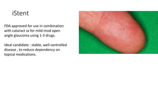 Minimally invasive Glaucoma surgery MIGS | PPTX