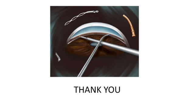 Minimally invasive Glaucoma surgery MIGS | PPT