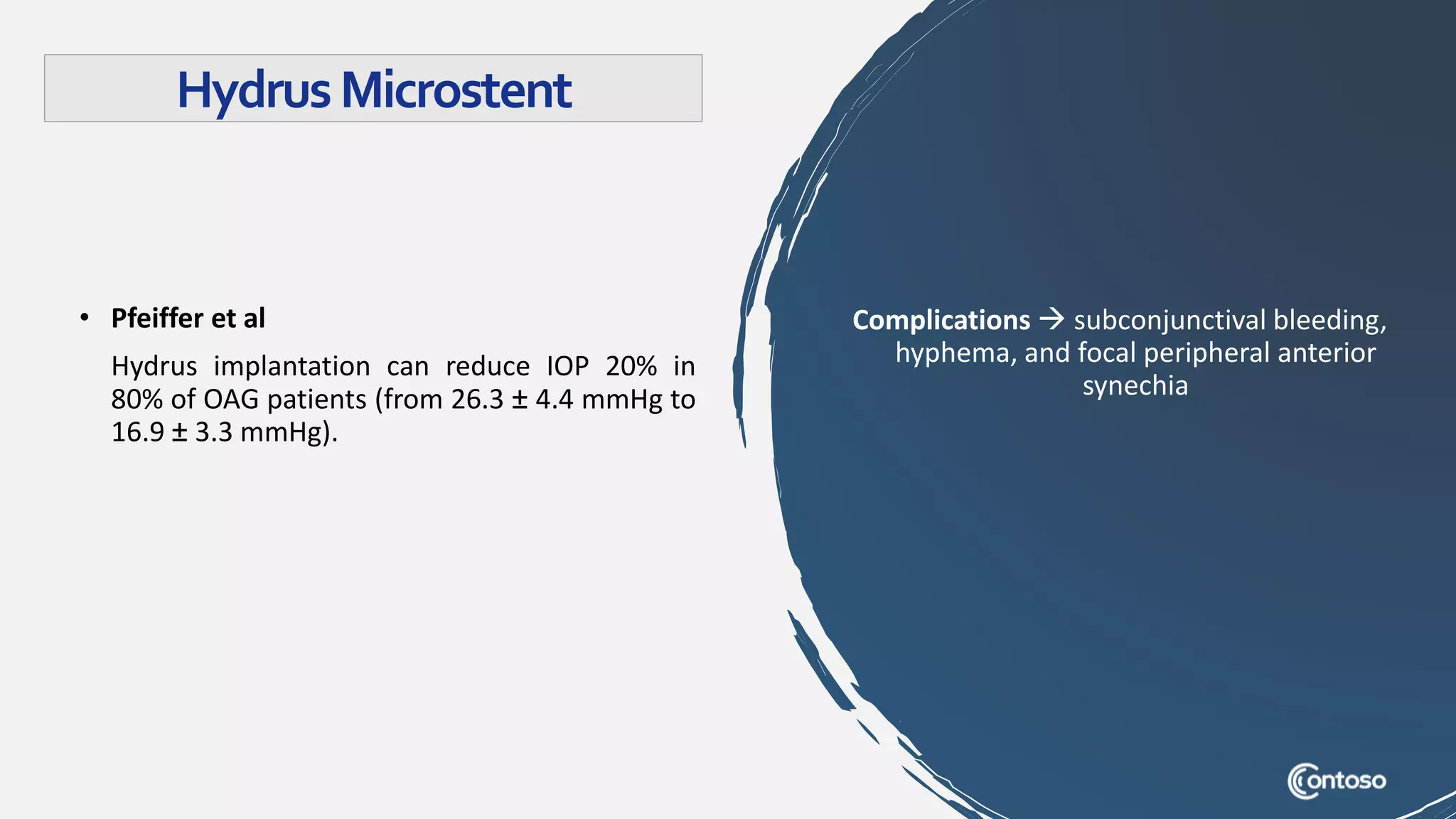 Minimally Invasive Glaucoma Surgery (MIGS) | PPT