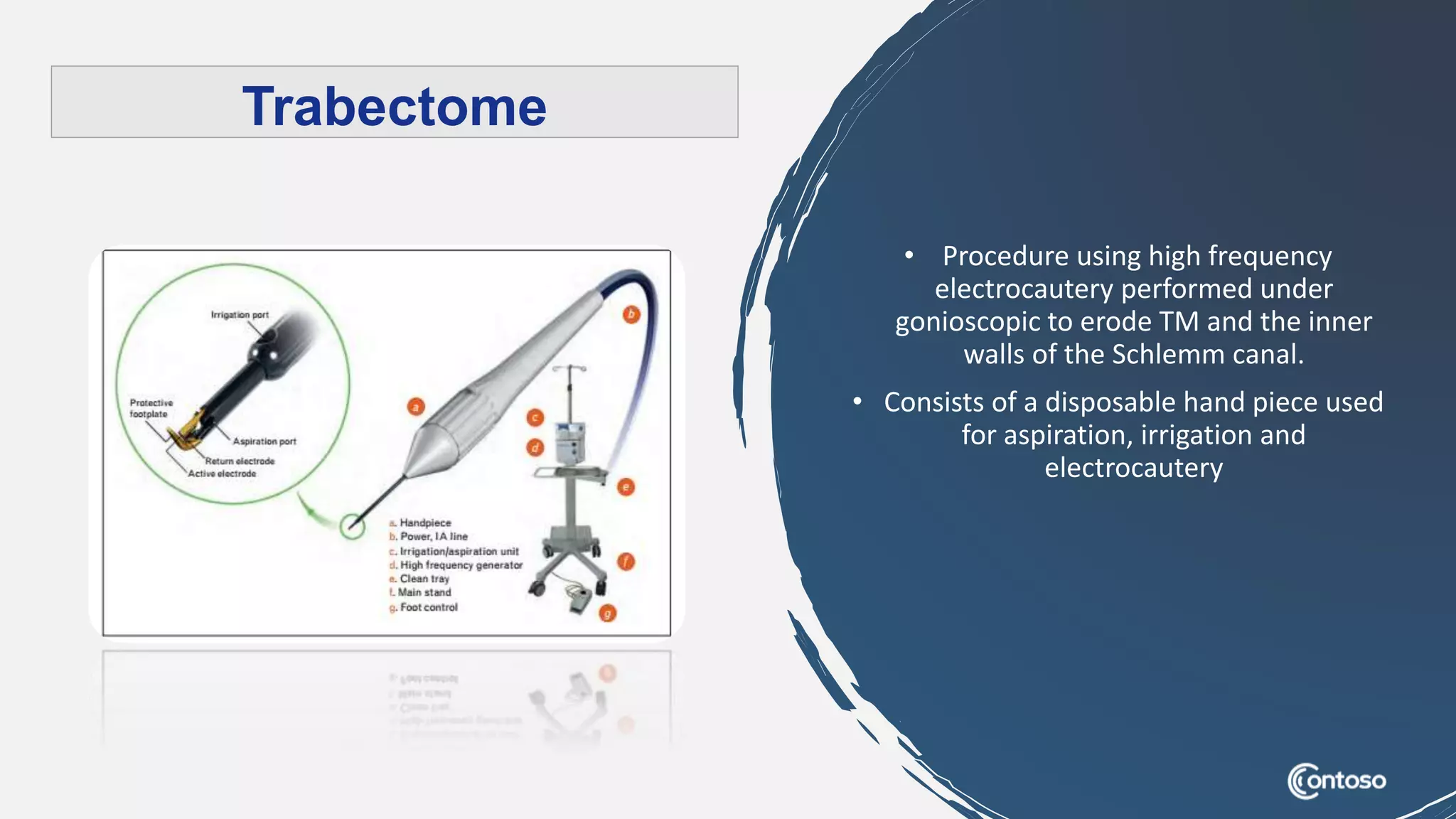 Minimally Invasive Glaucoma Surgery (MIGS) | PPT