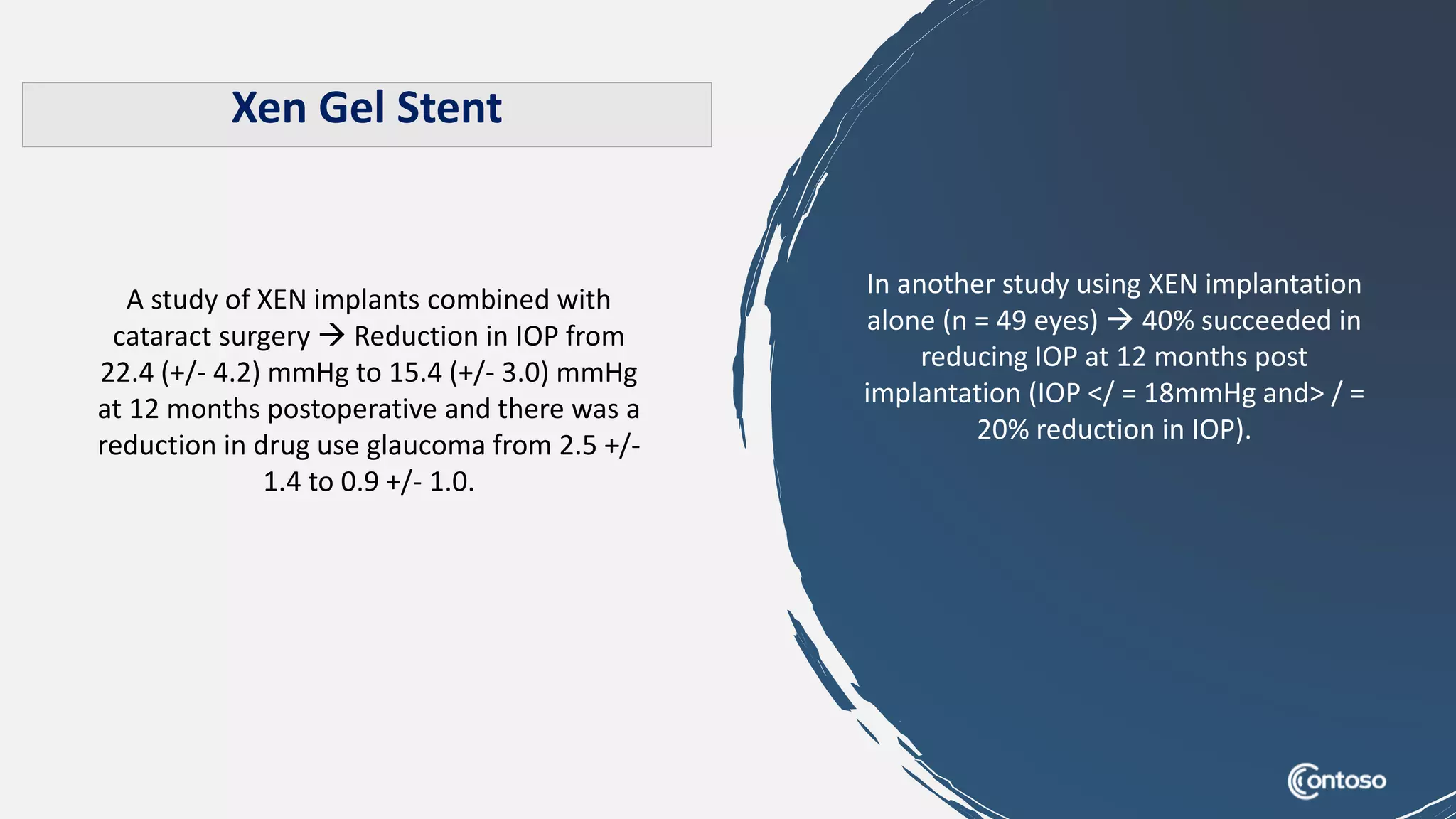 Minimally Invasive Glaucoma Surgery (MIGS) | PPT