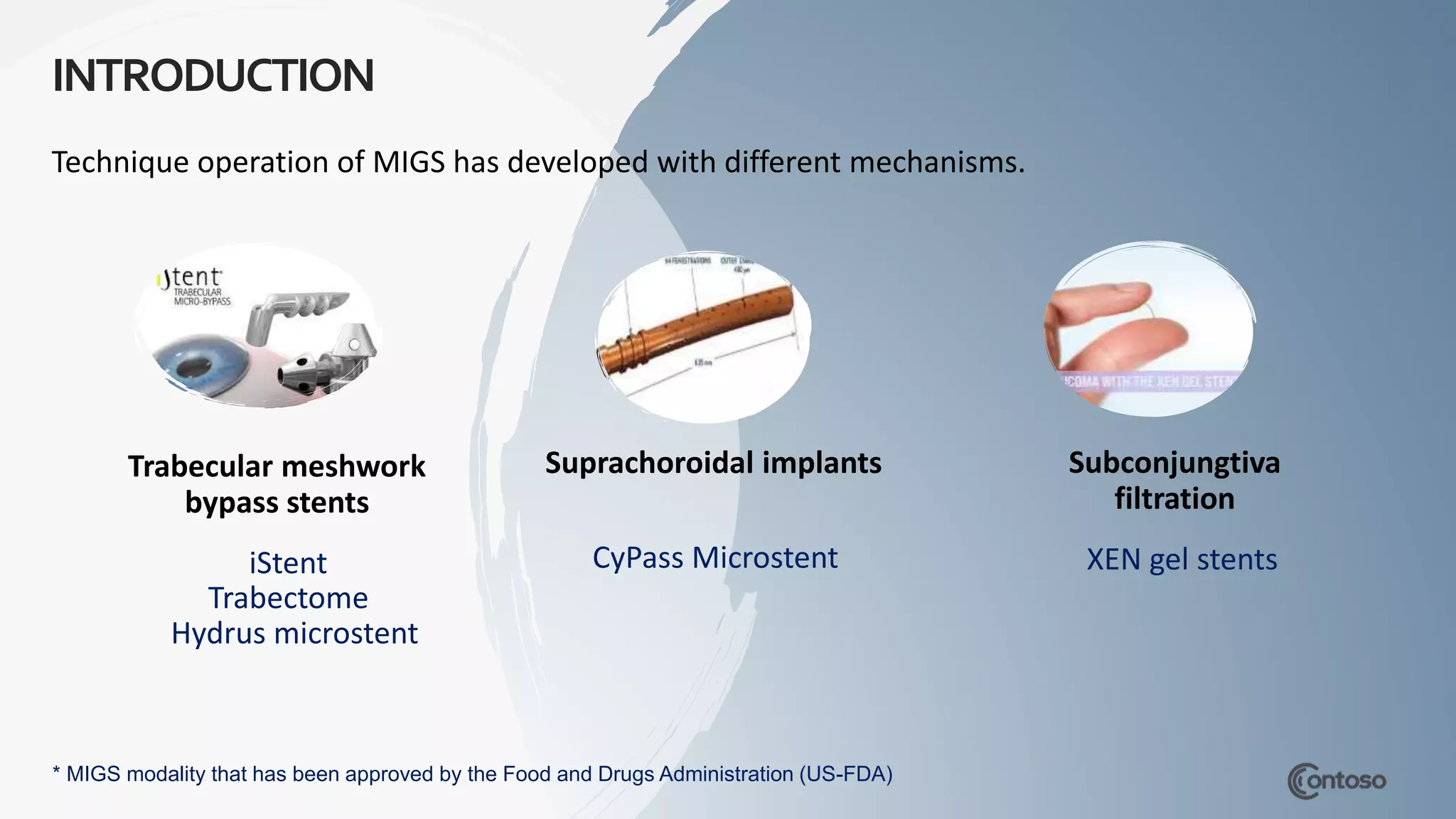 Minimally Invasive Glaucoma Surgery (MIGS) | PPT