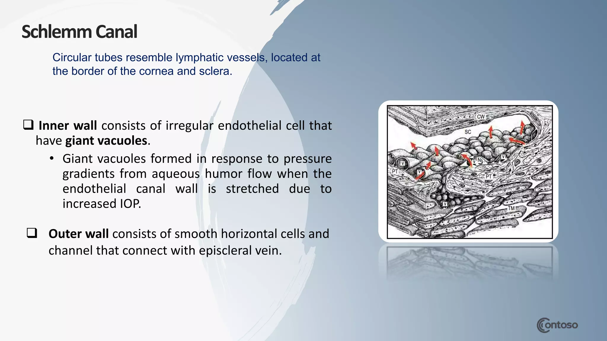 Minimally Invasive Glaucoma Surgery Migs Ppt Eye And Vision