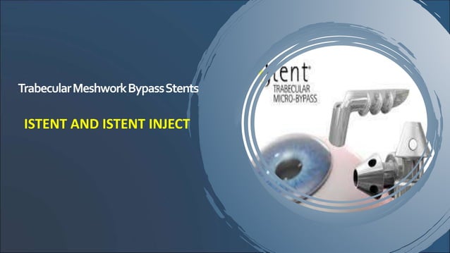 Minimally Invasive Glaucoma Surgery Migs Ppt Eye And Vision