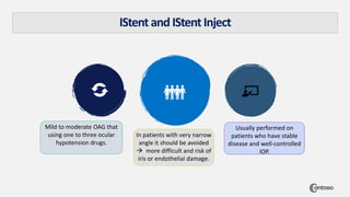 Minimally Invasive Glaucoma Surgery (MIGS) | PPT