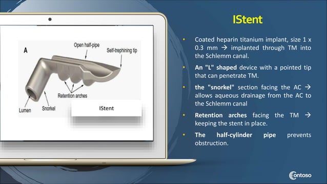 Minimally Invasive Glaucoma Surgery (MIGS) | PPT | Eye and Vision ...