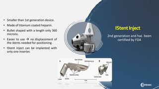 Minimally Invasive Glaucoma Surgery (MIGS) | PPT