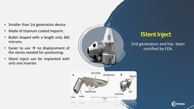Minimally Invasive Glaucoma Surgery (MIGS) | PPT | Eye and Vision ...
