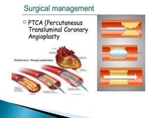 Myocardial Infarction | PPTX