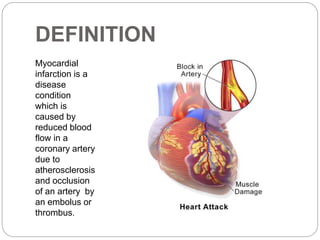Myocardial infarction | PPTX