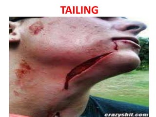 mi_incised_wound.ppt