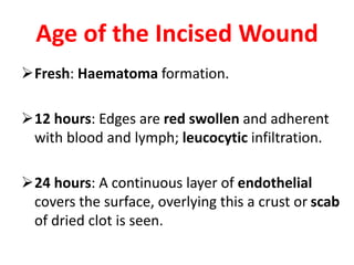 mi_incised_wound.ppt