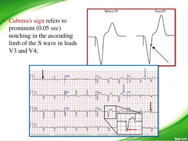 1# – Podajmy Atarax