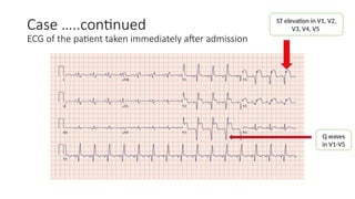 acute coronary syndrome integrated wityh biochemistry and pathology.pptx