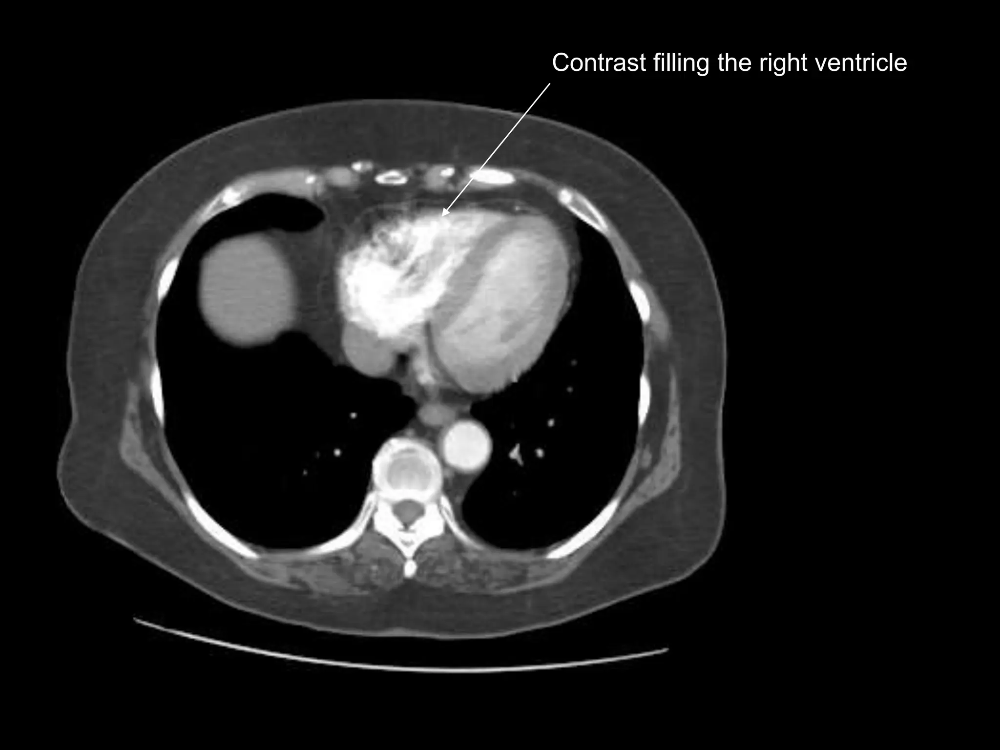 Mike's CT Chest tests, ct scan education | PPT