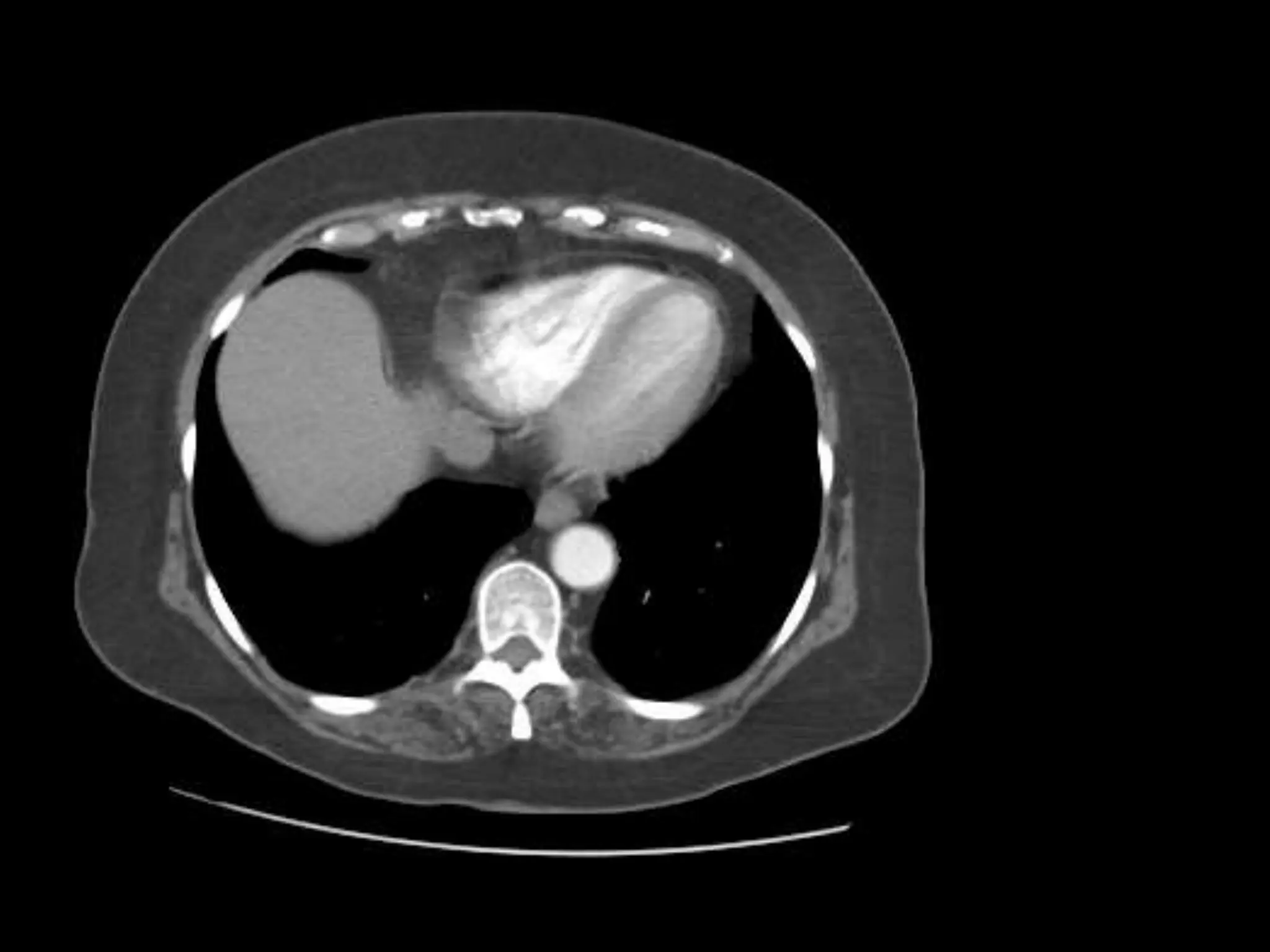 Mike's CT Chest tests, ct scan education | PPT