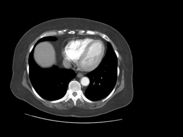 Mike's CT Chest tests, ct scan education | PPT