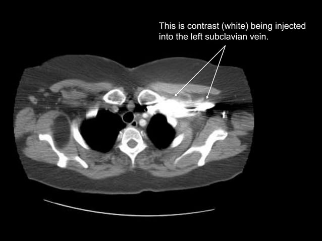 Mike's CT Chest tests, ct scan education | PPT