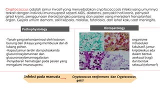 mikologi khusus cyptococcus dan histoplasma.pptx
