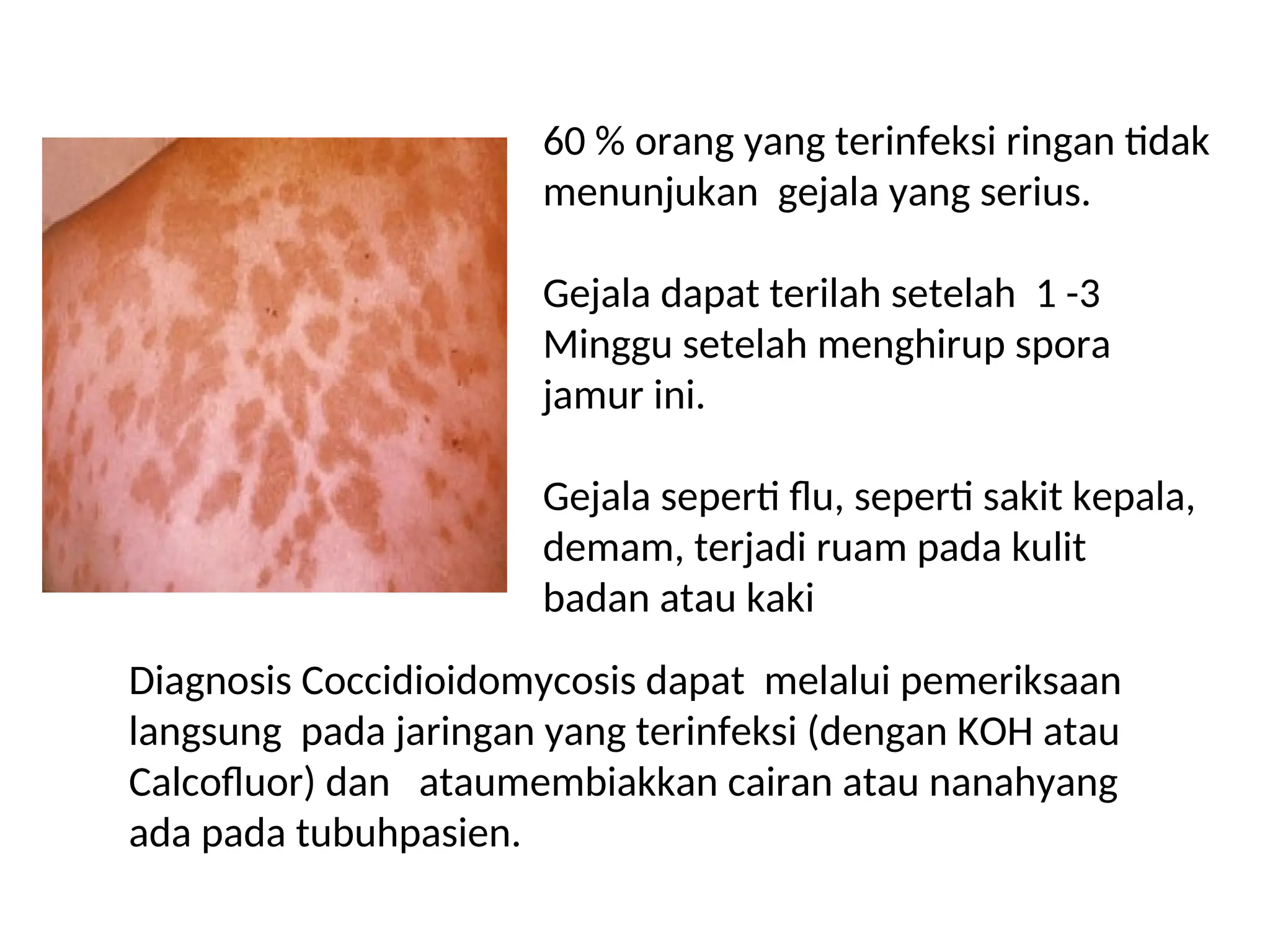 MIKOSIS SISTEMIK penyakit kulit pada manusia | PPT