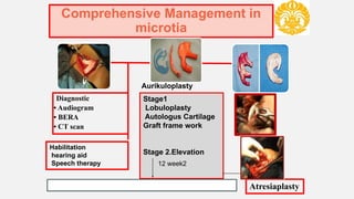 mikrotia : abnormalitas bentuk daun telinga | PDF